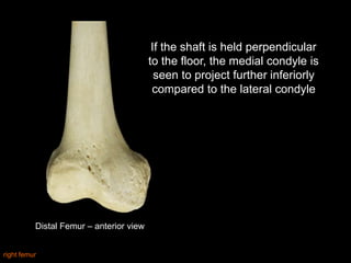 Lateral Condyle Femur