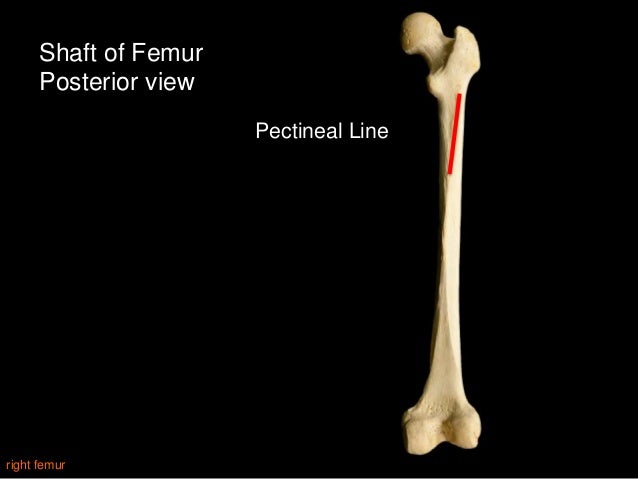 Pectineal Line Of Femur