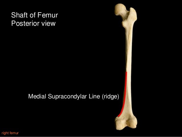 Lateral And Medial Supracondylar Ridges