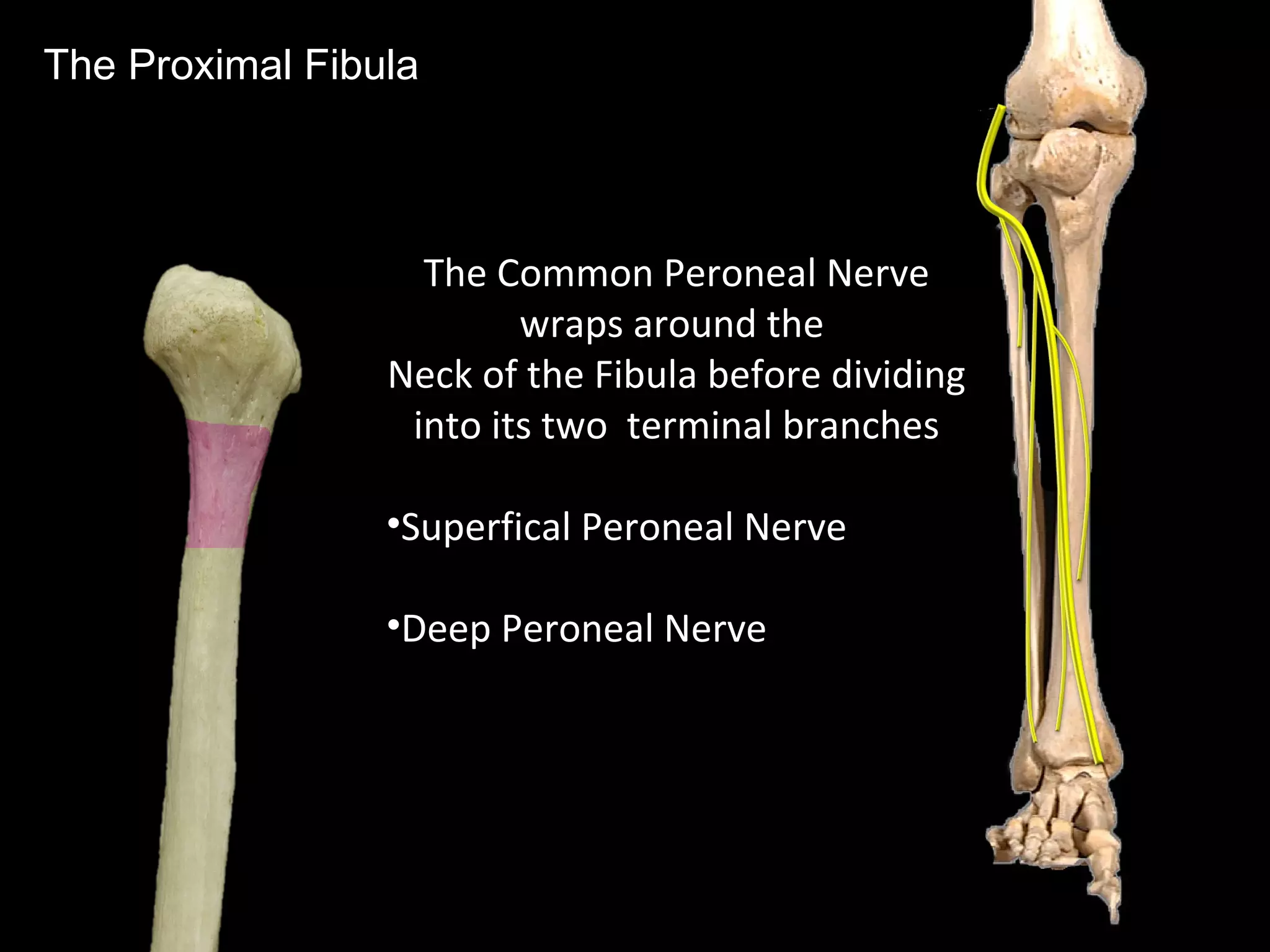 Slideshow: Fibula | PPT
