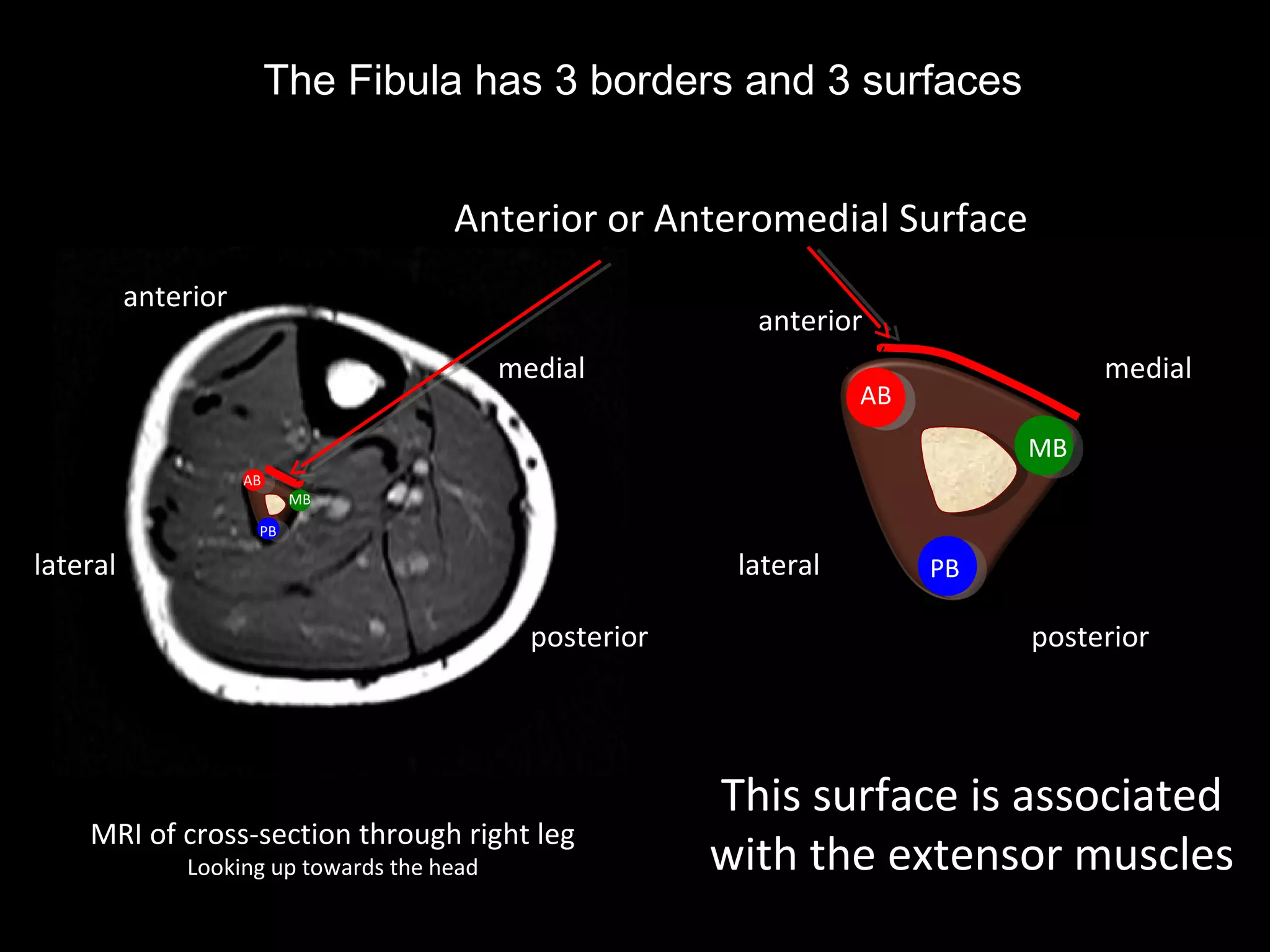 Slideshow: Fibula | PPT