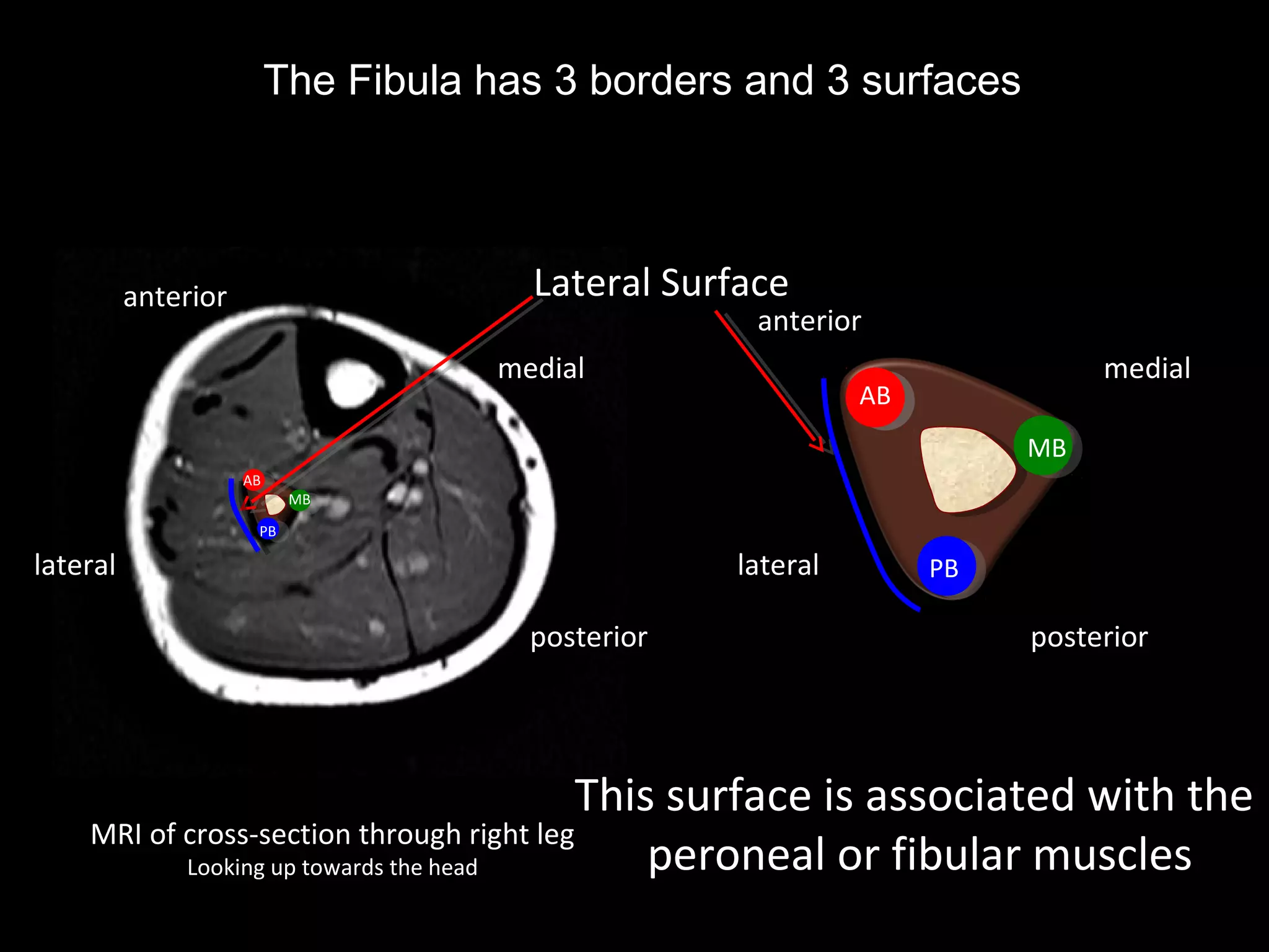 Slideshow: Fibula | PPT