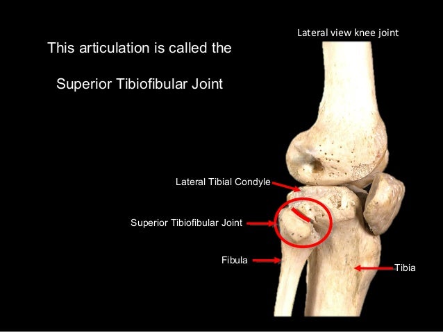 Slideshow: Fibula