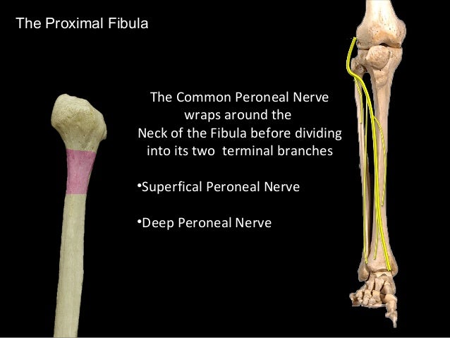 Slideshow: Fibula