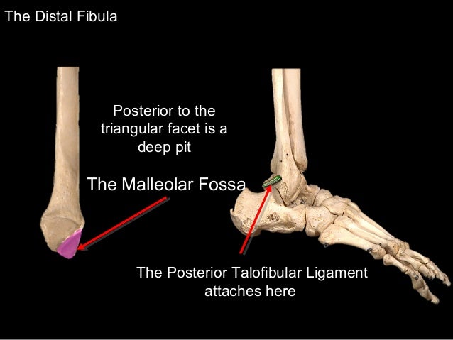 Slideshow: Fibula