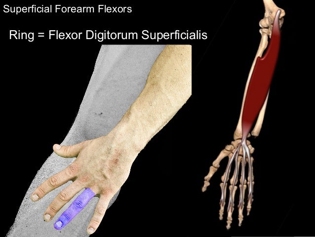 Slideshow: Forearm Superficial Flexors
