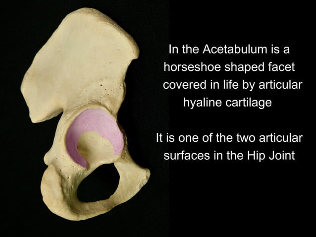 Slideshow: Hip Bone | PPT