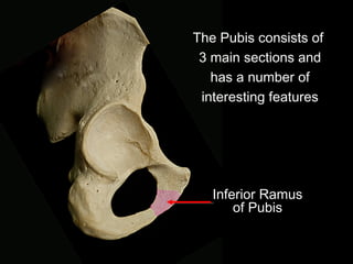 Pubic Crest Tubercle