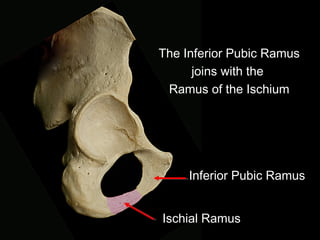 Ramus Of Ischium