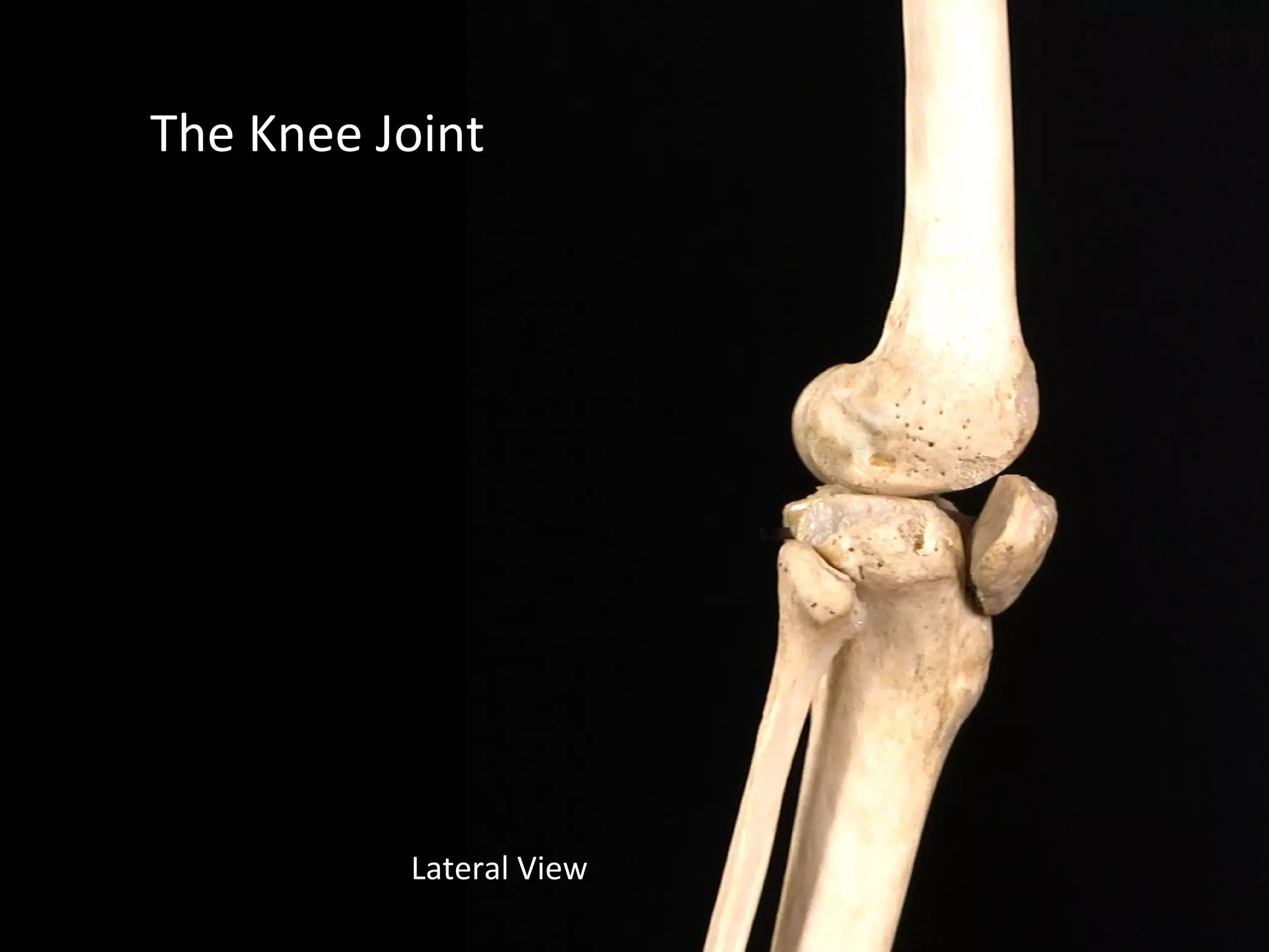Slideshow: Knee Joint | PPT