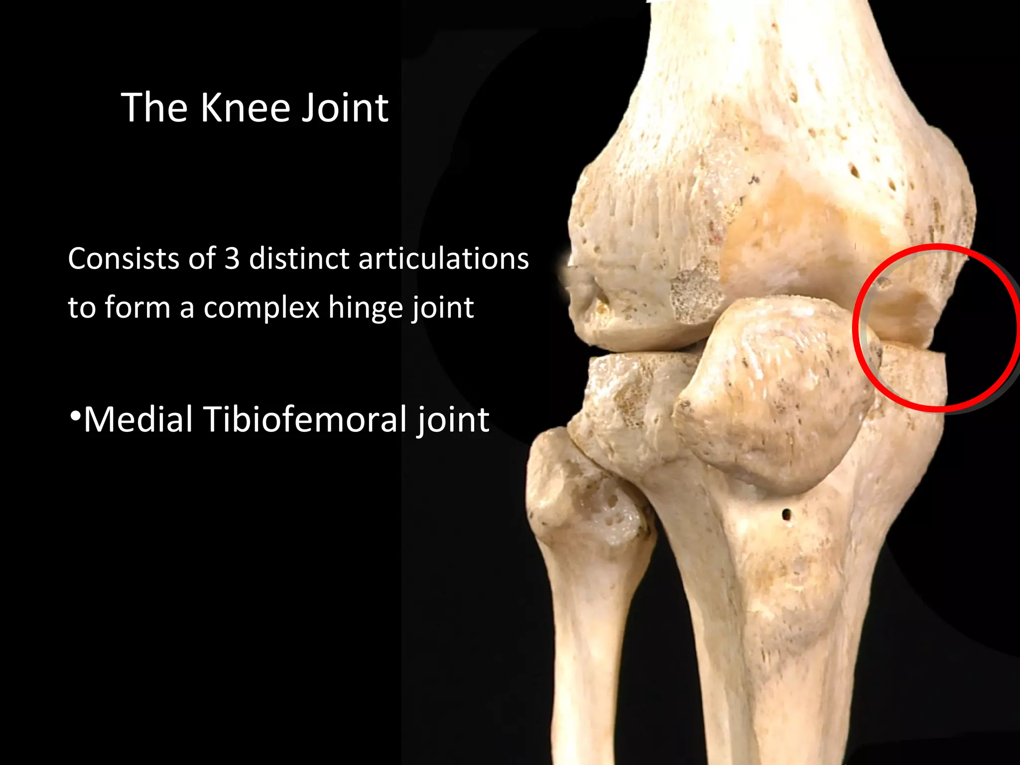 Slideshow: Knee Joint | PPT