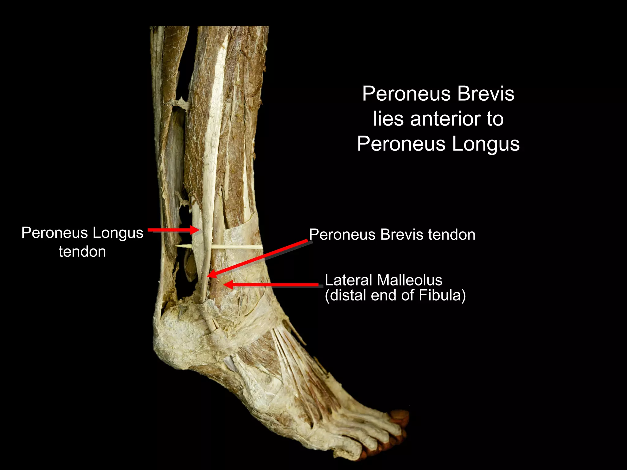 Slideshow: Lateral Leg | PPT