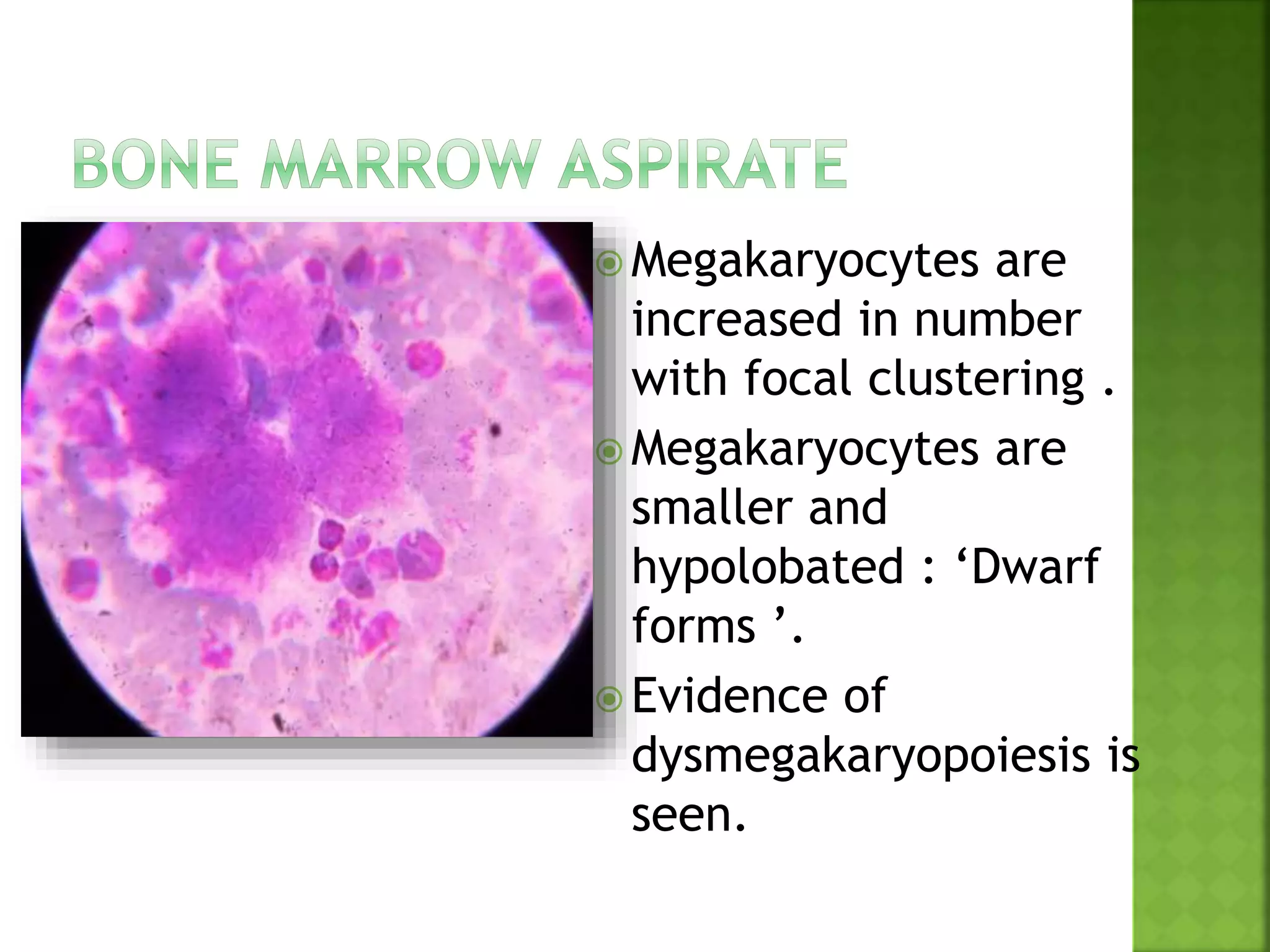 leukemoid reaction and leukemia | PPTX