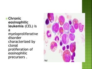 leukemoid reaction and leukemia | PPT