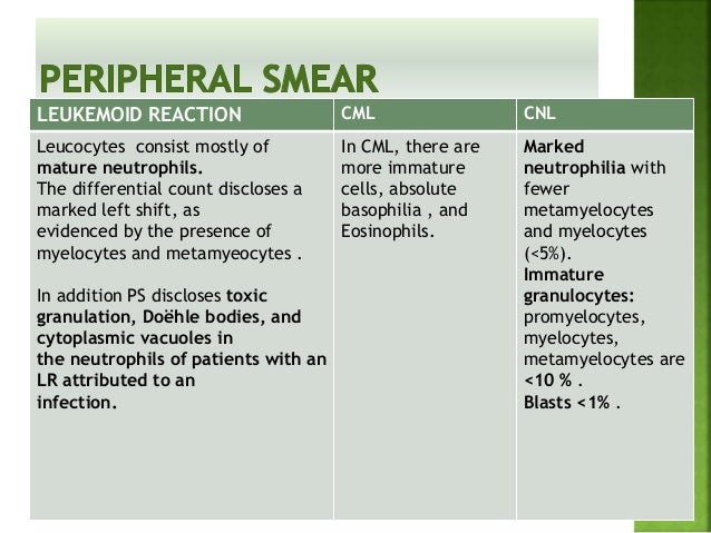 leukemoid reaction and leukemia
