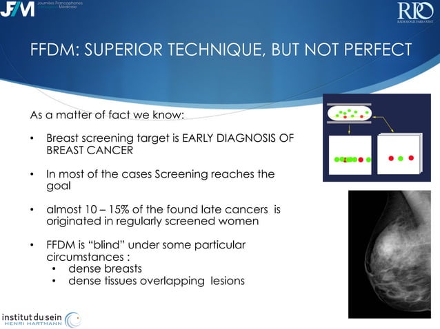Luc Rotenberg : Digital Breast Tomosynthesis | PDF | 3-D Graphics ...