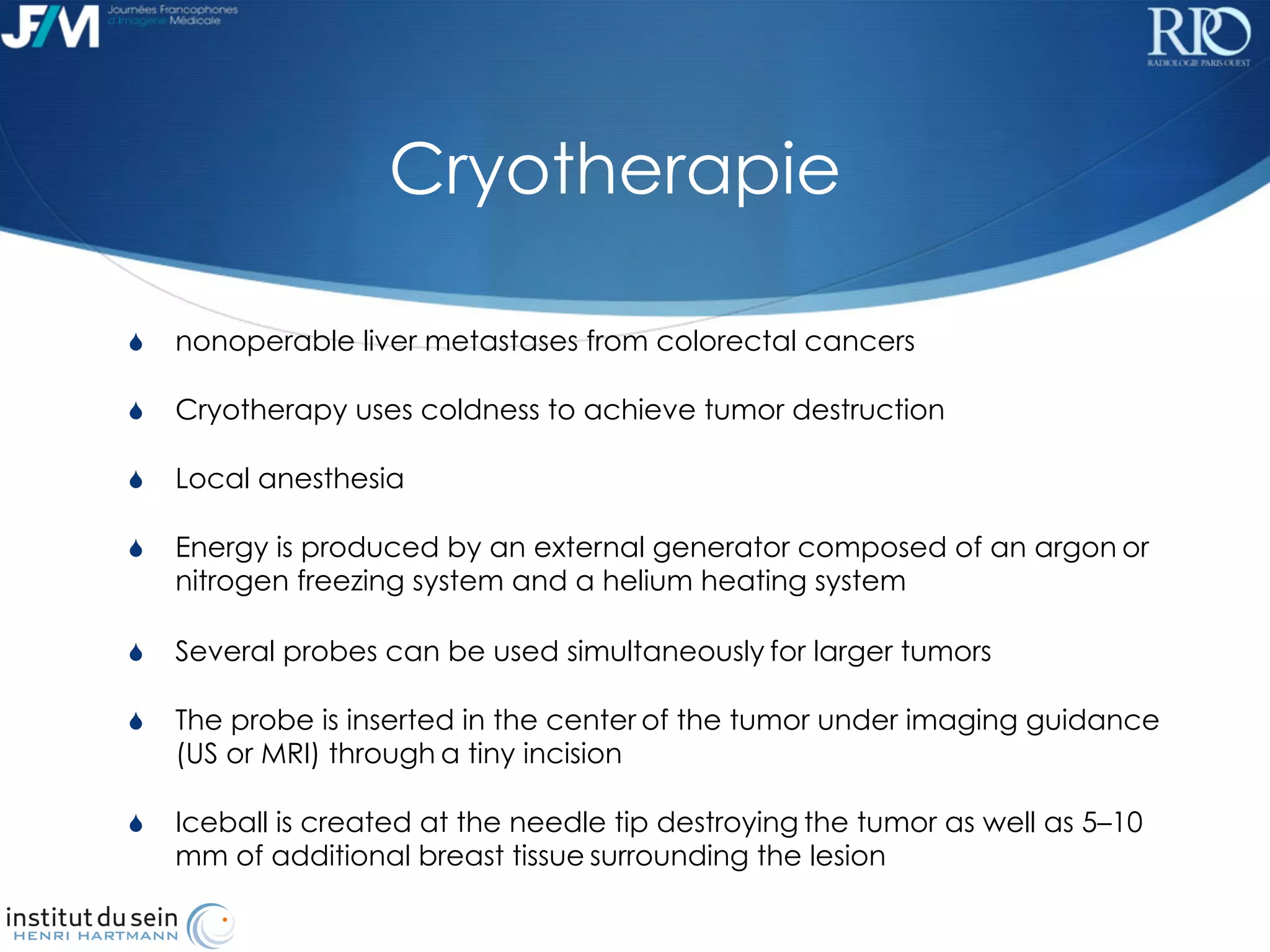 Luc Rotenberg : US guided vacuum breast biopsy and minimal Invasive ...