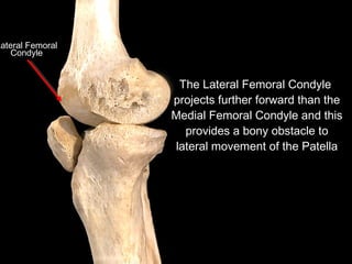 Slideshow: Patella | PPT