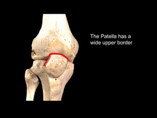 Slideshow: Patella | PPT