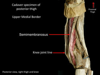 SLideshow: Popliteal Fossa | PPT