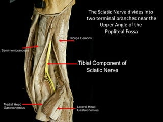 Tibial Nerve Cadaver