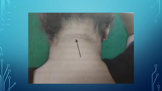 PCOS POLYCYSTIC OVARIAN SYNDROME- ETIOLOGY, PATHOLOGY, HISTOLOGY ...