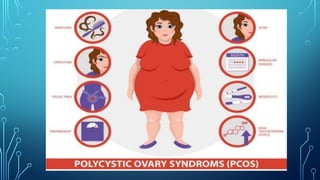 PCOS POLYCYSTIC OVARIAN SYNDROME- ETIOLOGY, PATHOLOGY, HISTOLOGY ...