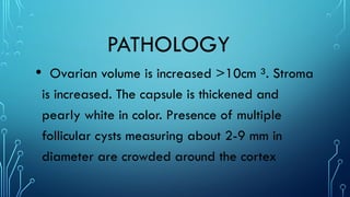 PCOS POLYCYSTIC OVARIAN SYNDROME- ETIOLOGY, PATHOLOGY, HISTOLOGY ...