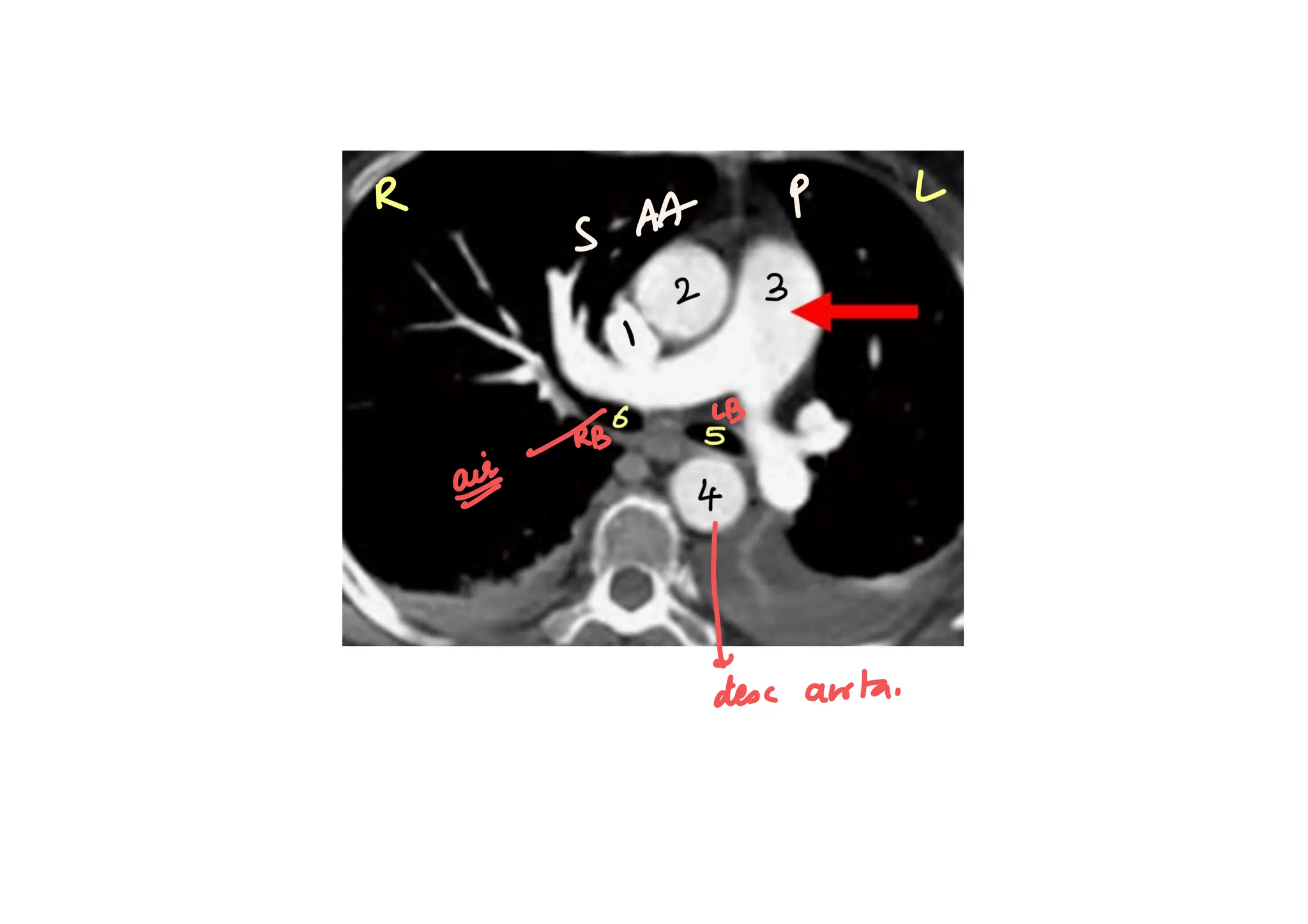 LRR_RADIOLOGY_aiimsneetpgINICET%20(2).pdf