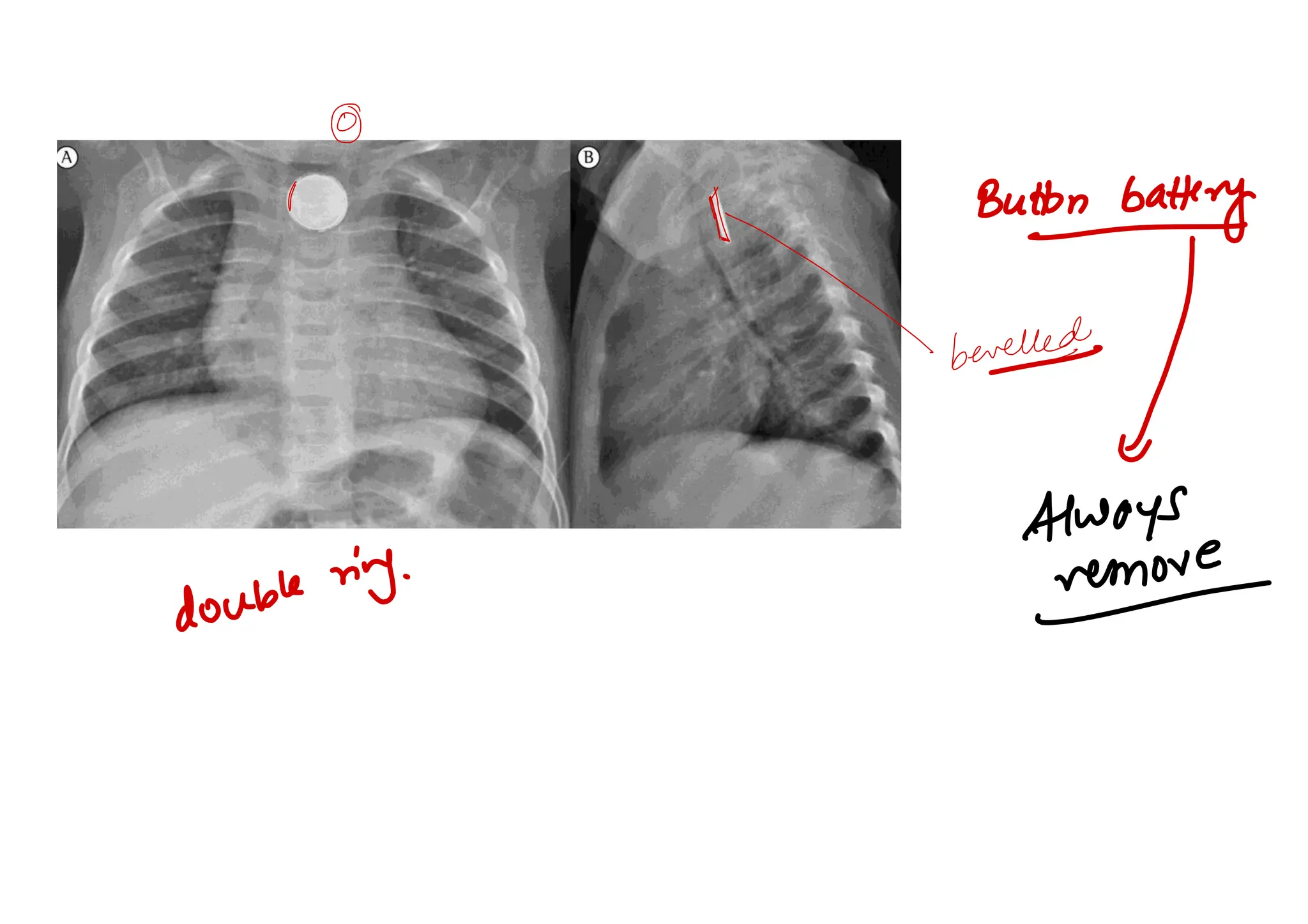 LRR_RADIOLOGY_aiimsneetpgINICET%20(2).pdf