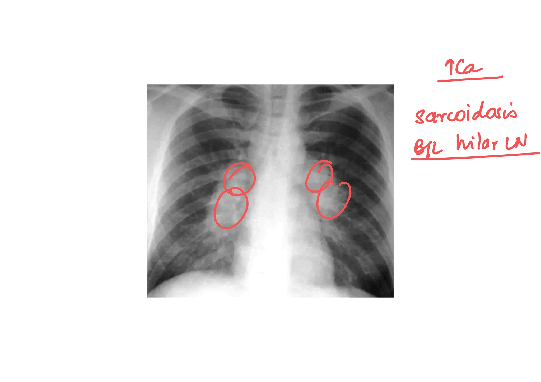 LRR_RADIOLOGY_aiimsneetpgINICET%20(2).pdf