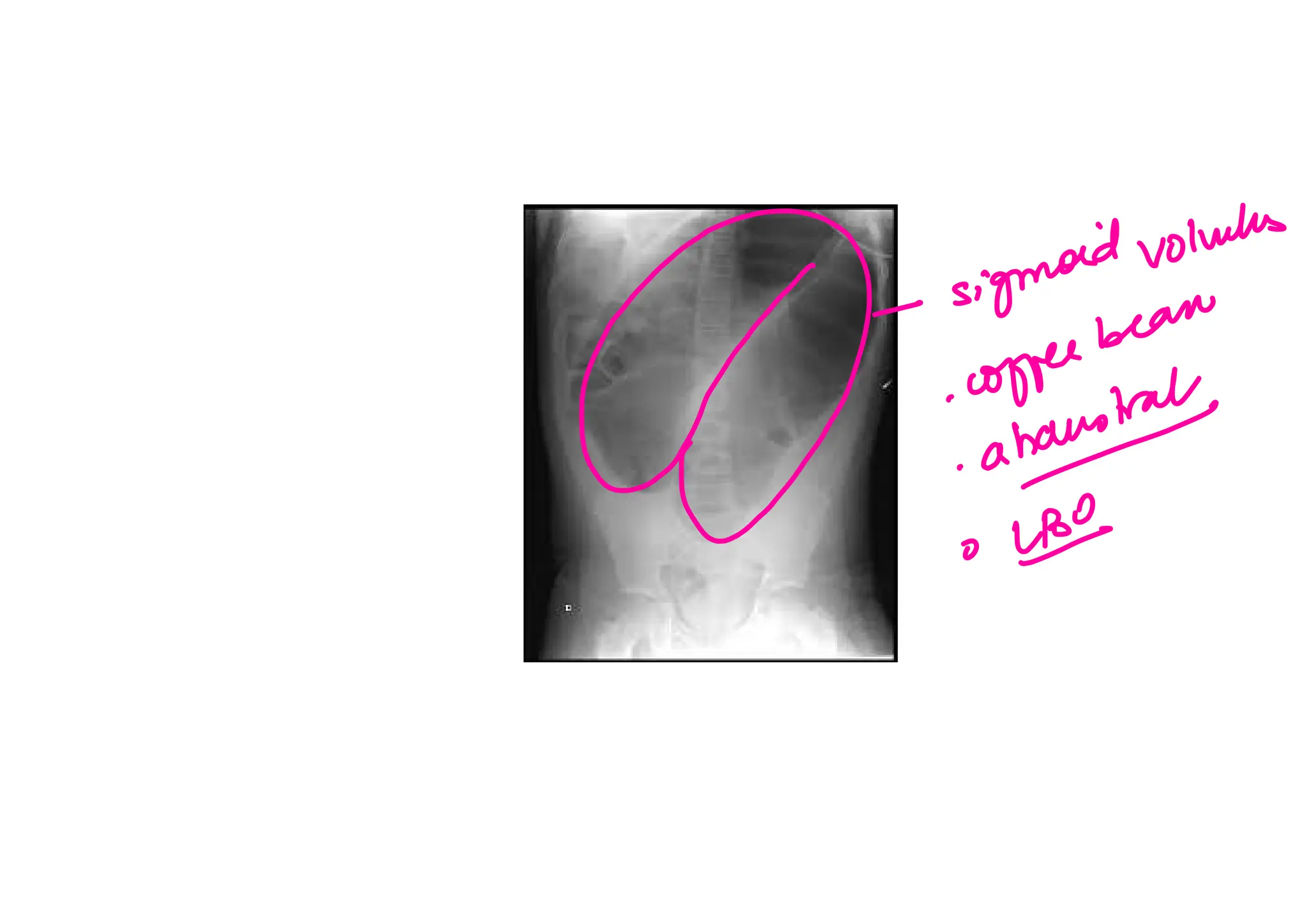 LRR_RADIOLOGY_aiimsneetpgINICET%20(2).pdf