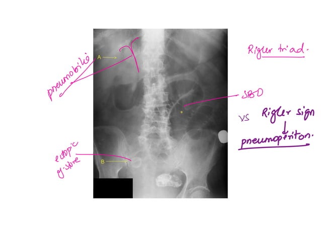 LRR_RADIOLOGY_aiimsneetpgINICET%20(2).pdf