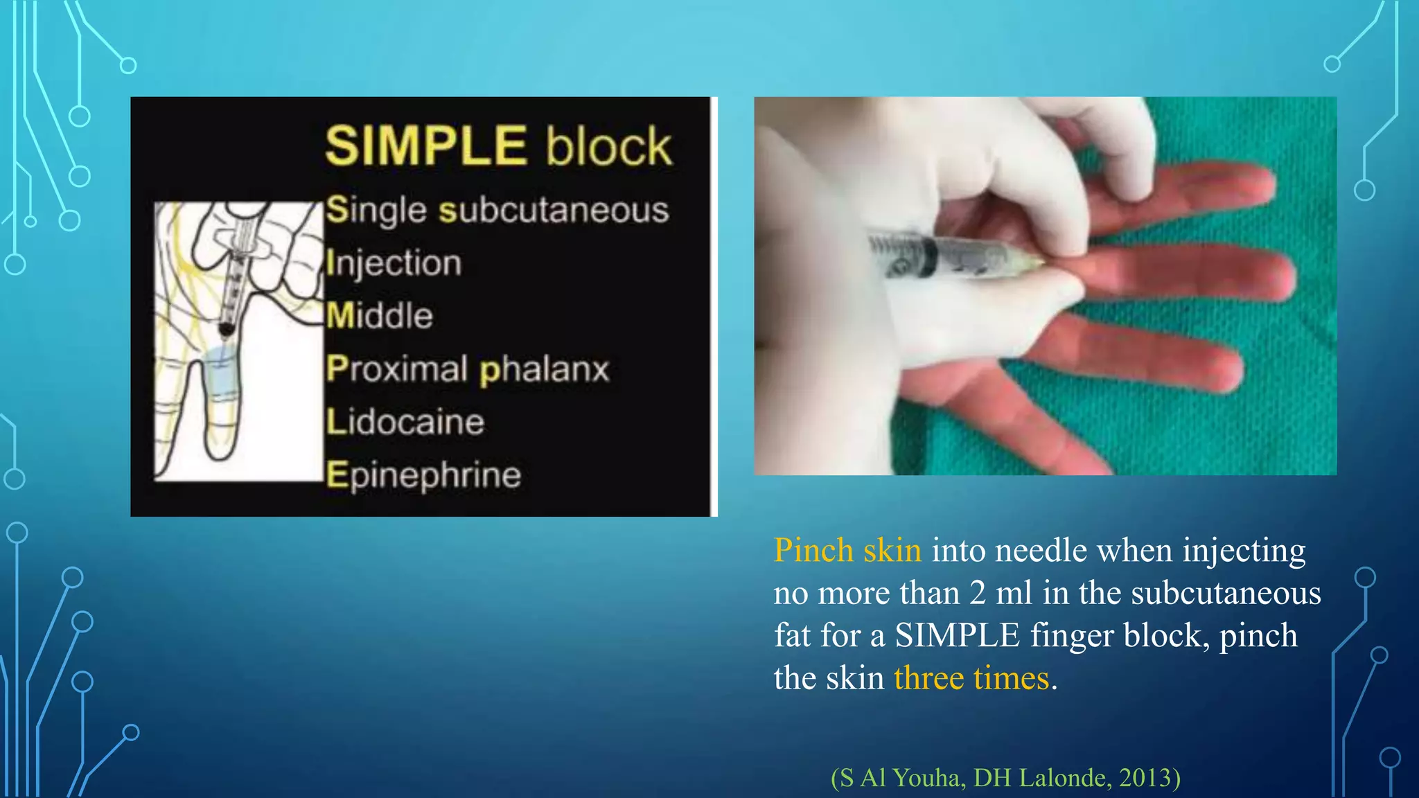 WALANT -Wide Awake Local Anesthesia No Tourniquet Surgery Technique | PPTX