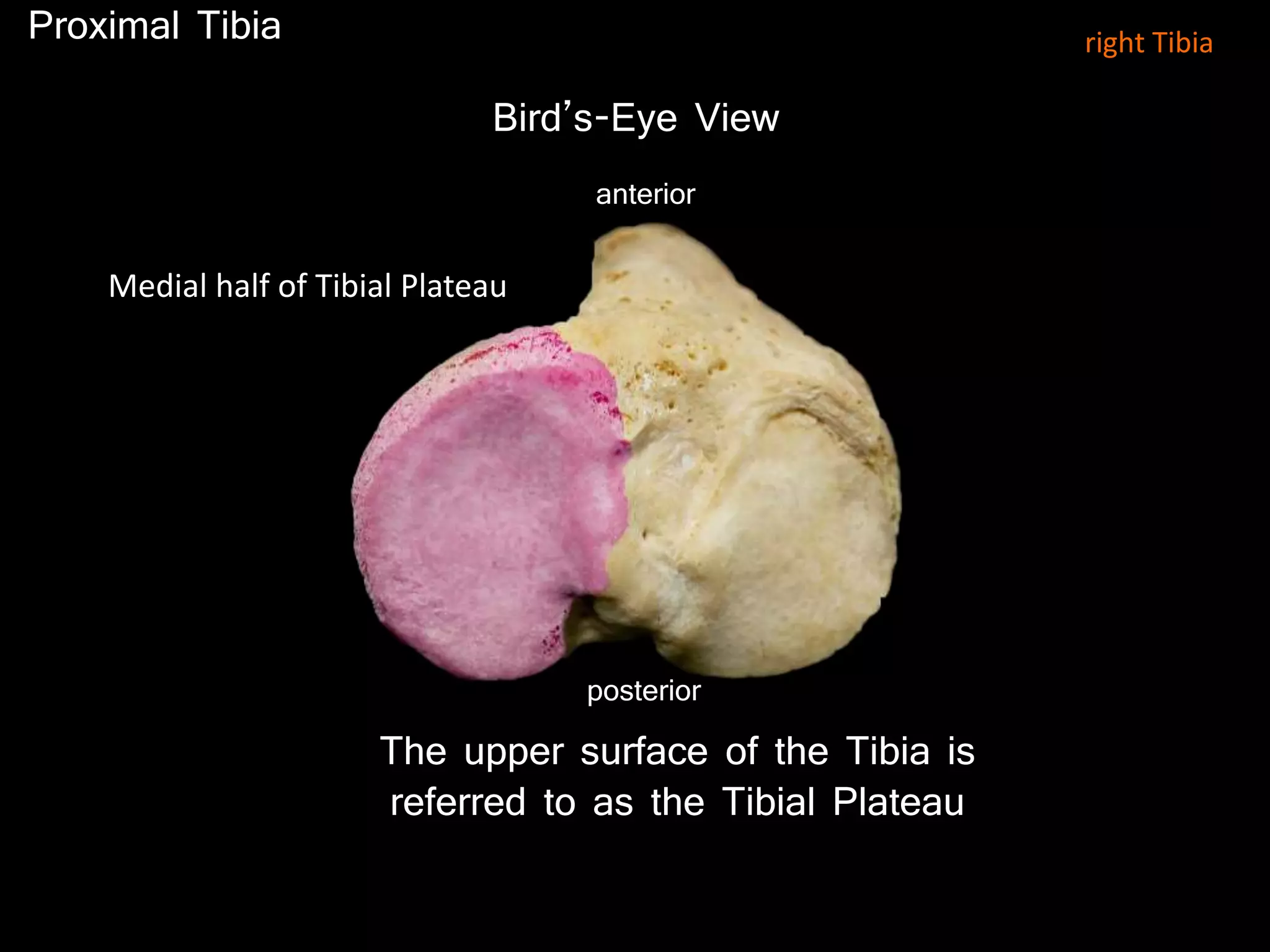 Slideshow: Tibia | PPTX