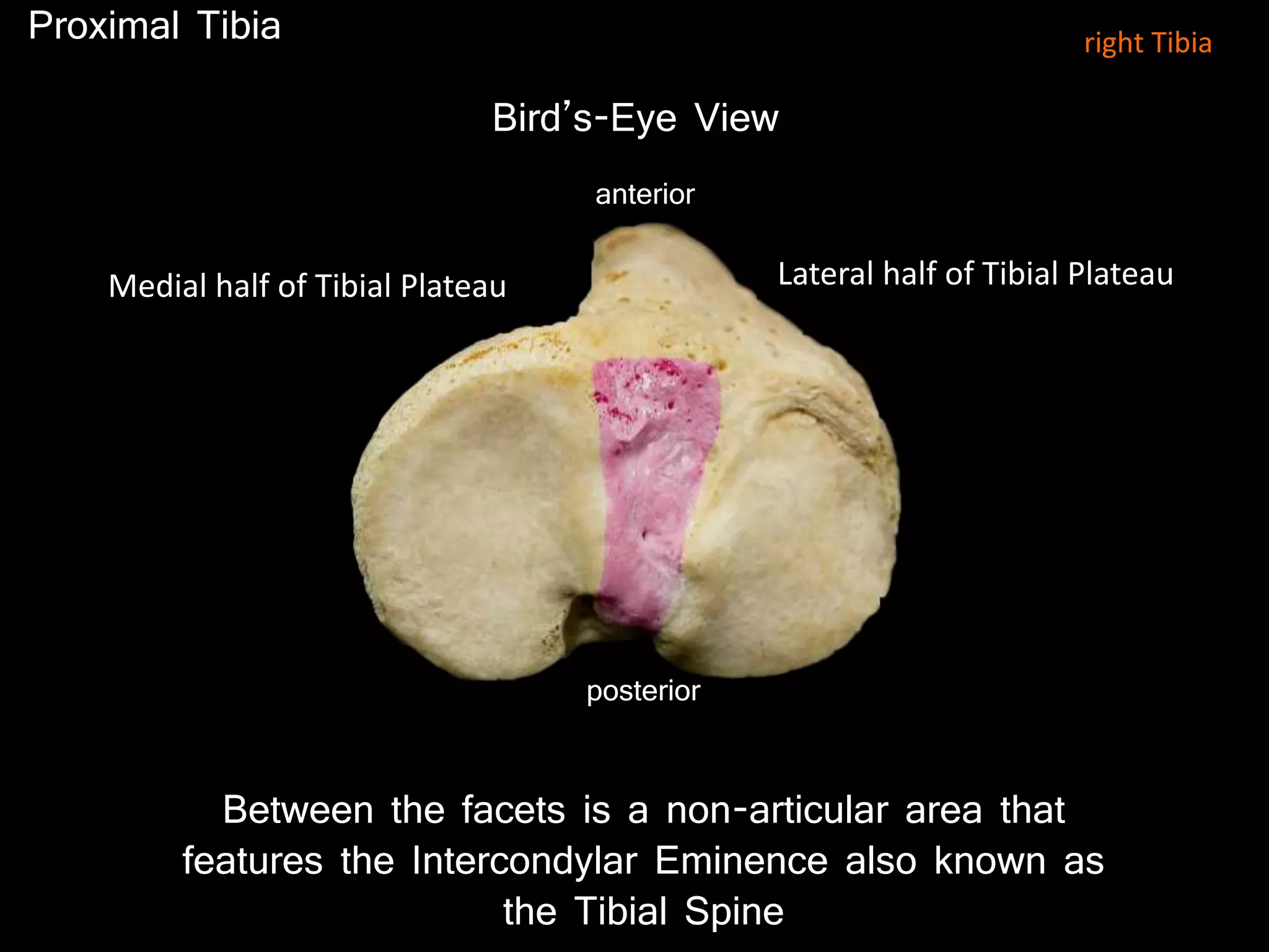 Slideshow: Tibia | PPTX