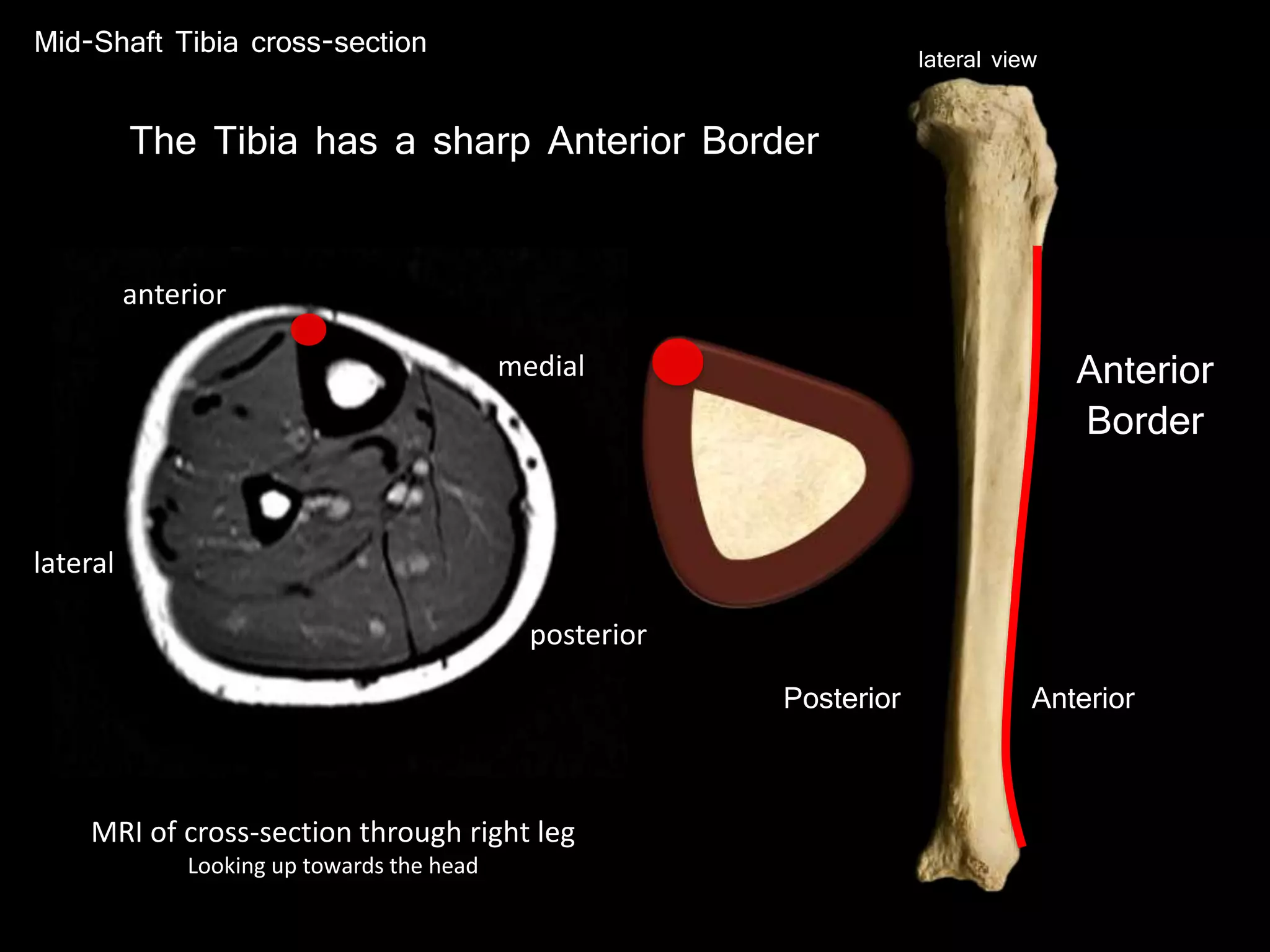 Slideshow: Tibia | PPTX