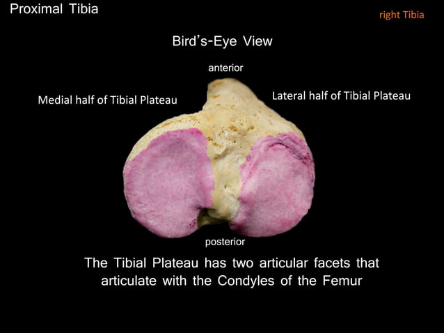 Slideshow: Tibia | PPTX | Death, Injury, or Military Conflict | Sensitive Topics
