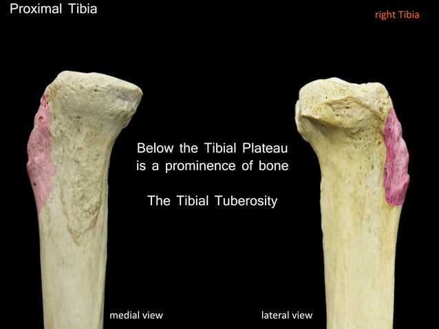 Slideshow: Tibia | PPT