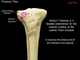Slideshow: Tibia | PPT