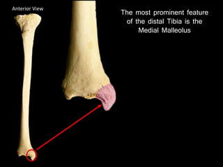 Distal Tibia Anatomy