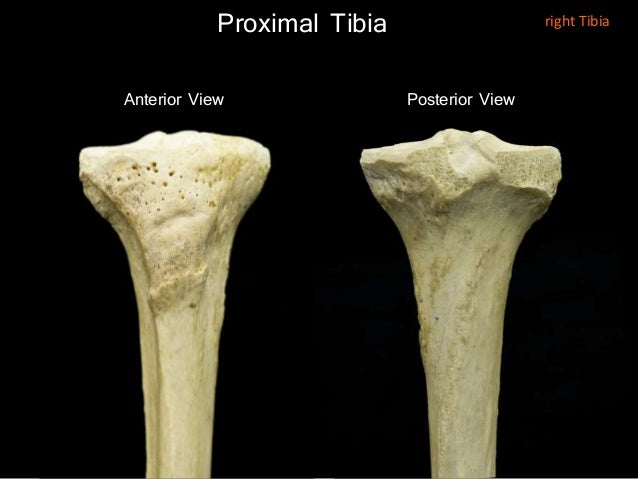 Slideshow: Tibia