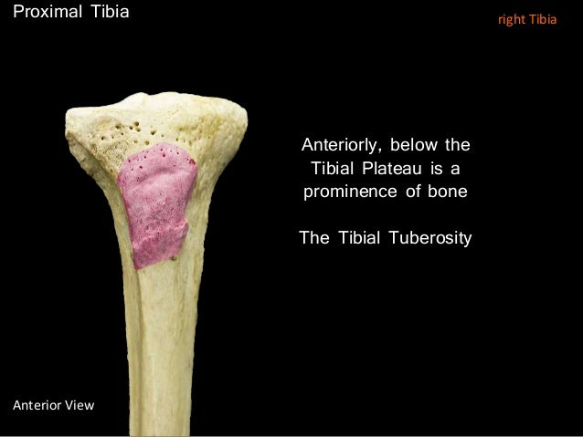 Slideshow: Tibia