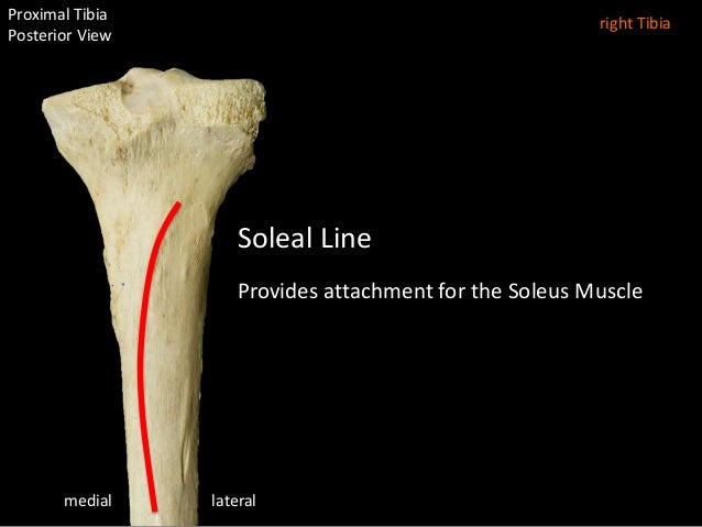 Slideshow: Tibia