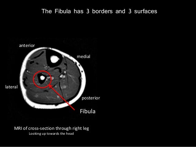 Slideshow: Tibia