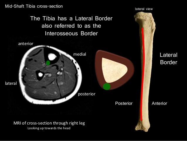 Slideshow: Tibia