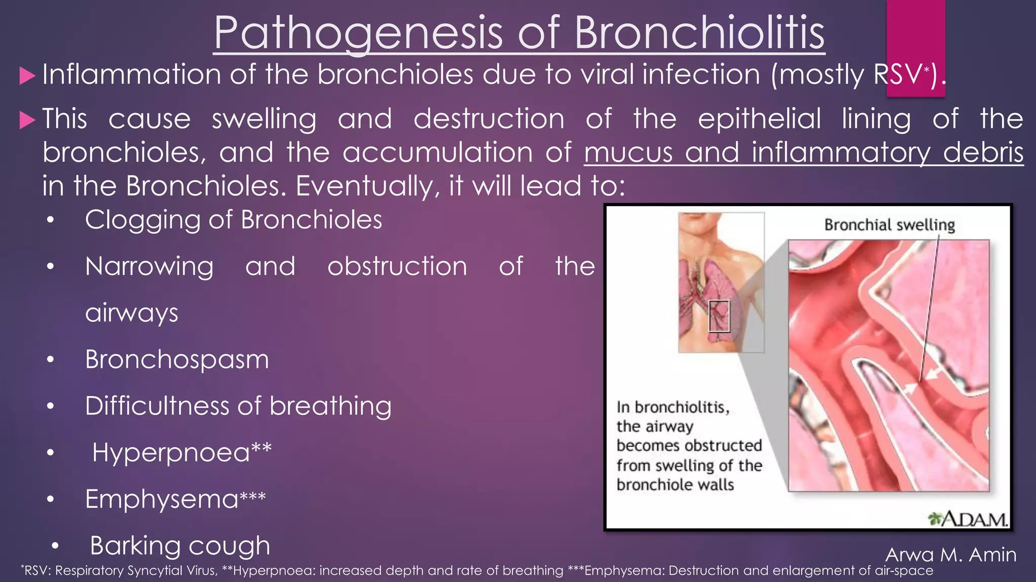 Bronchiolitis: An overview | PDF