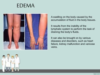 LS 2 9 The Lymphatic System | PPTX