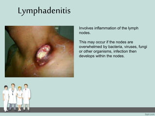 LS 2 9 The Lymphatic System | PPTX