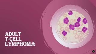 Leukemic stem cell and ATLL | PPTX